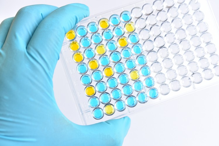 Laboratoriumanalyses allergenen | Allergenen Consultancy